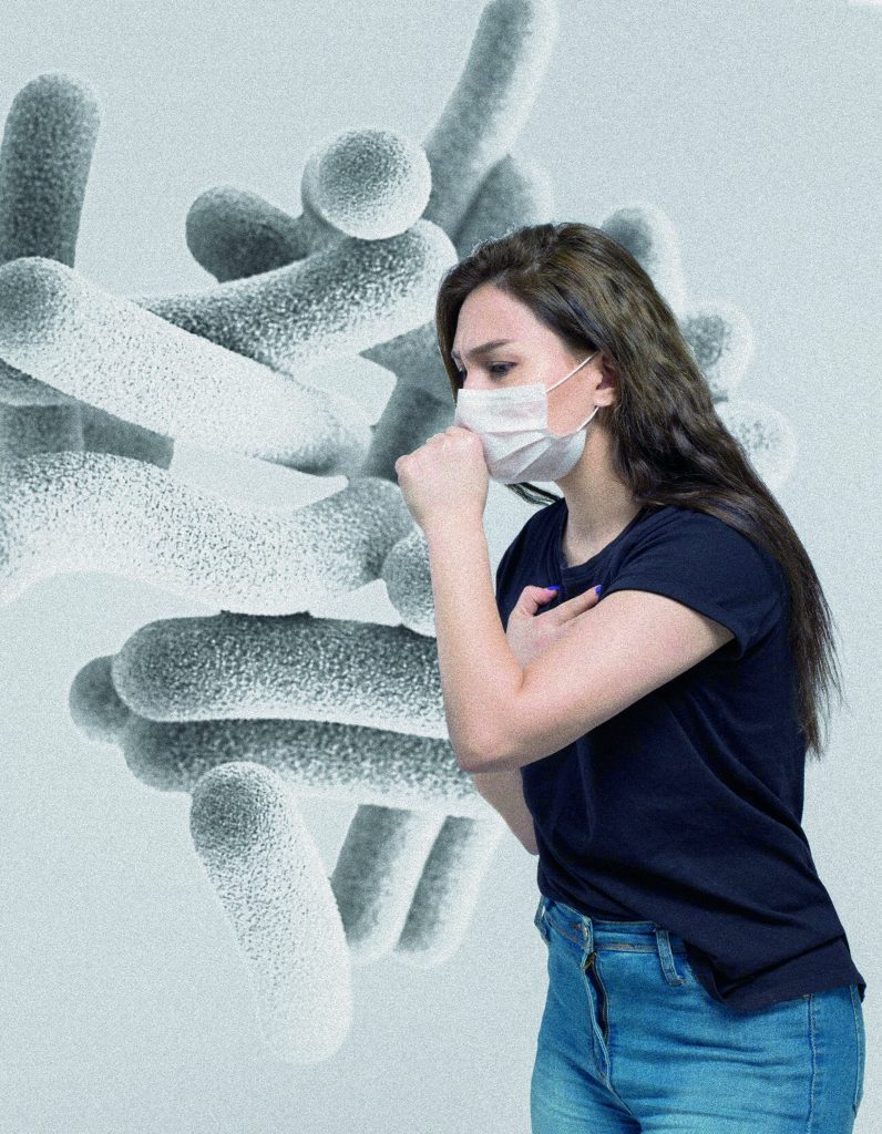 Tuberculosis resistente al tratamiento – Ciencia UANL