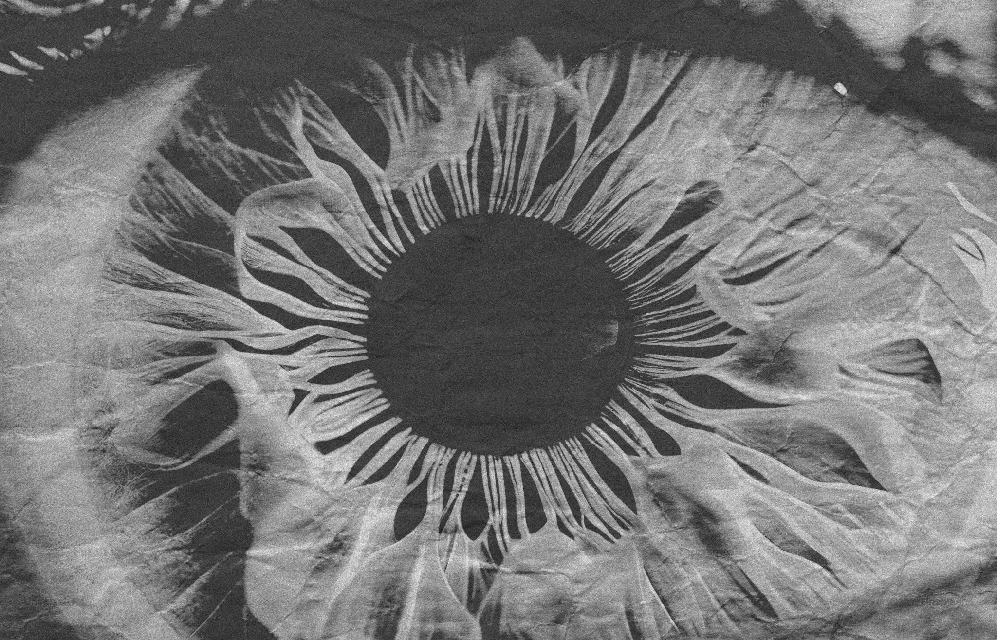 Pars planitis: una patología ocular que debe informarse – Ciencia UANL