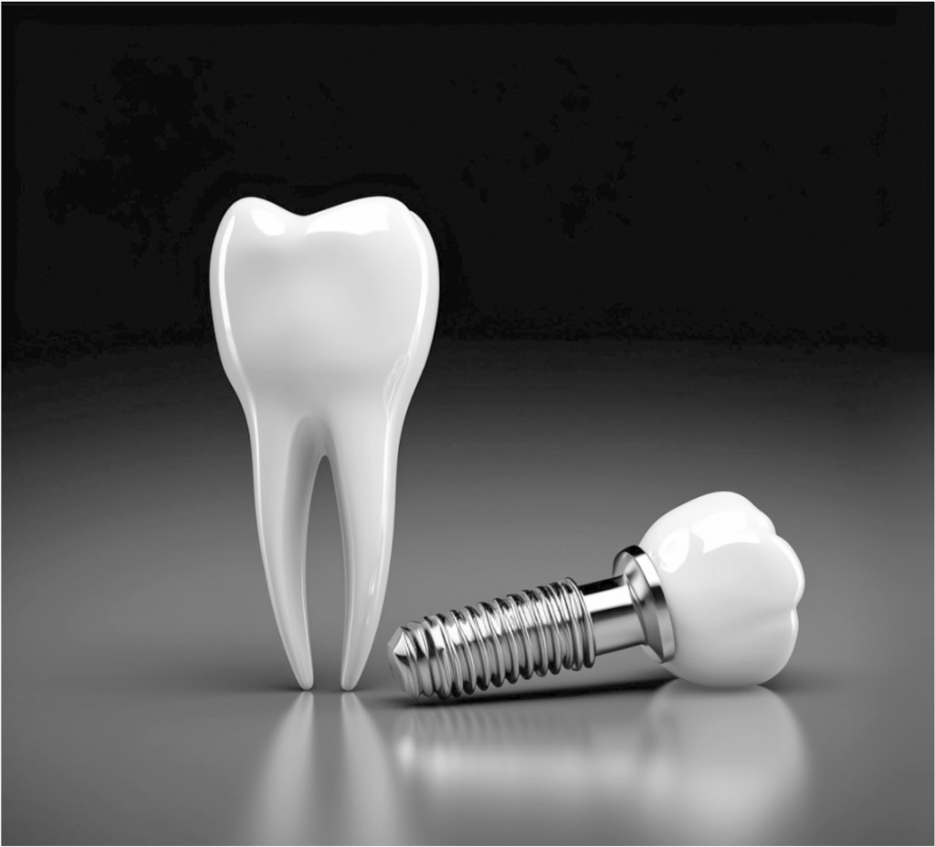 Biomateriales, aliados indispensables en la regeneración periodontal ...